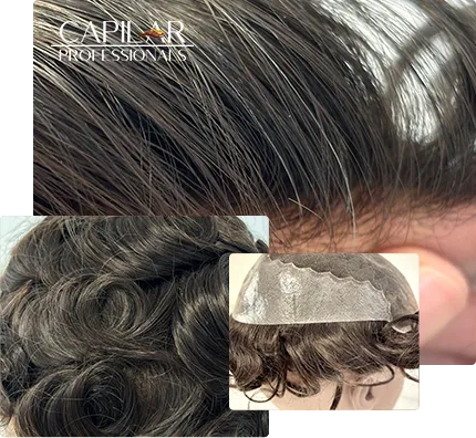 Prótesis Capilares Indetectables Capilar Professionals Barcelona